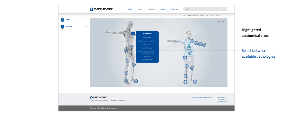 What is Orthofix ABS? - Orthofix