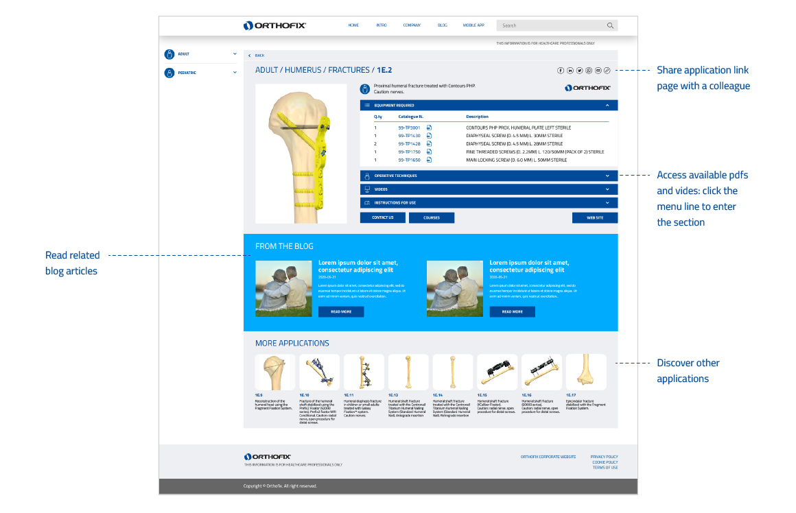 What is Orthofix ABS? - Orthofix
