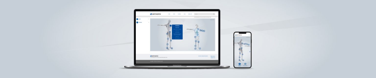 What is Orthofix ABS? - Orthofix