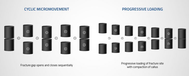 The Concept of Dynamization - Orthofix