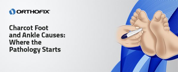 Charcot Foot and Ankle Disease: a quick diagnosis - Orthofix
