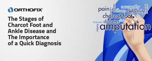 Charcot Foot and Ankle Disease: a quick diagnosis - Orthofix