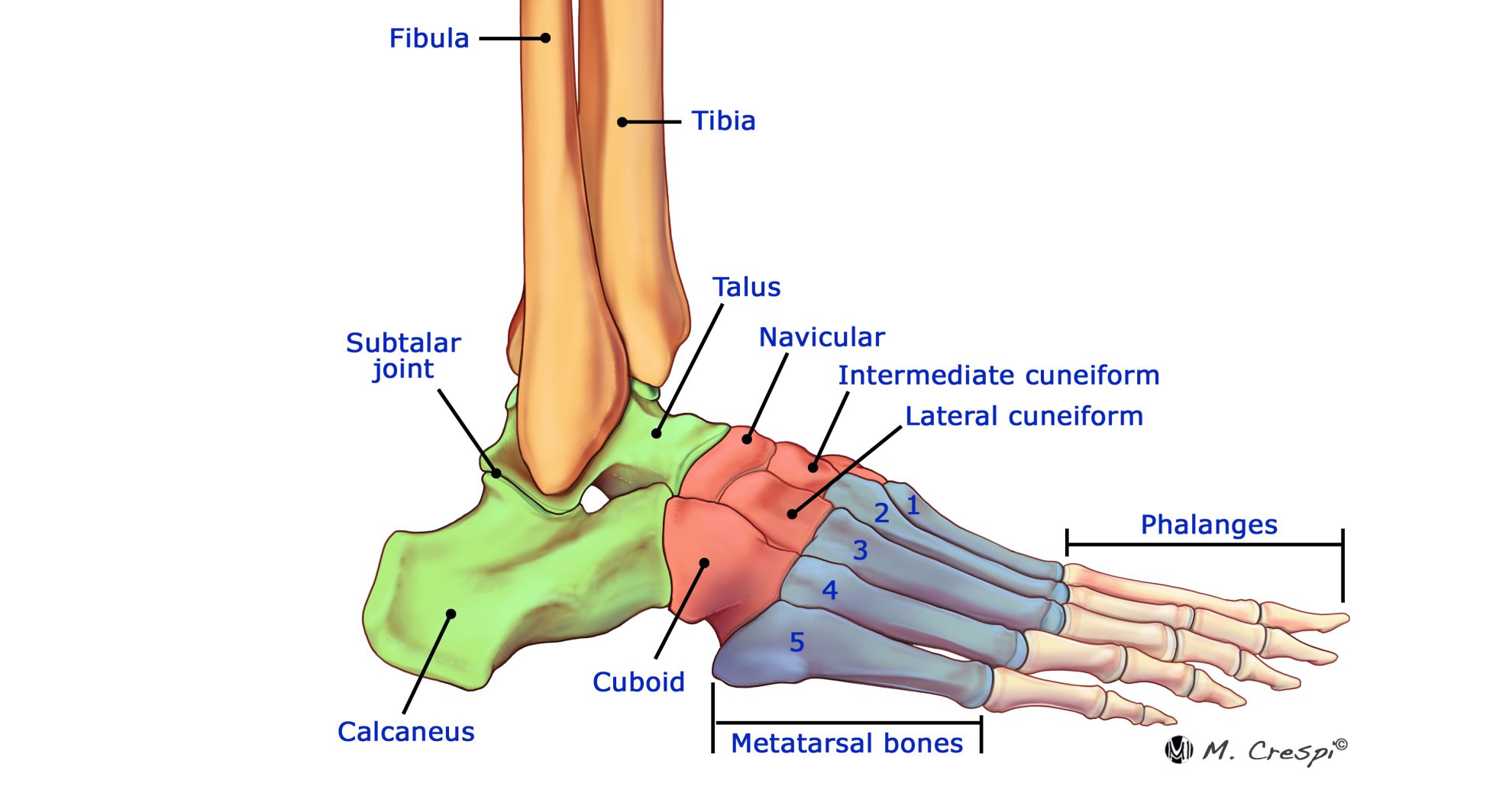 Surgical Management of the Charcot Ankle - Orthofix
