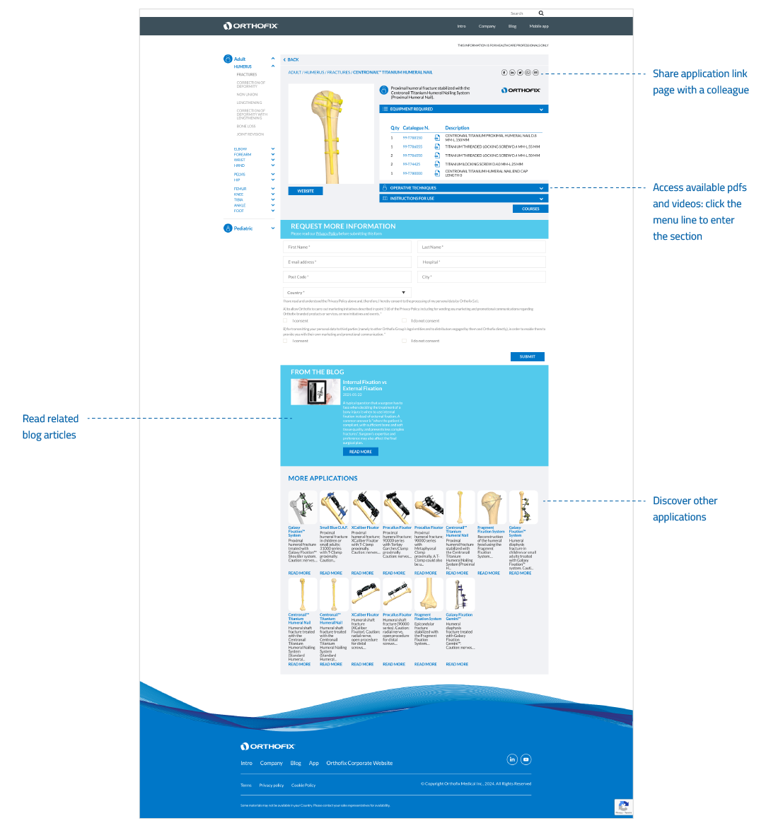 What is Orthofix ABS? - Orthofix