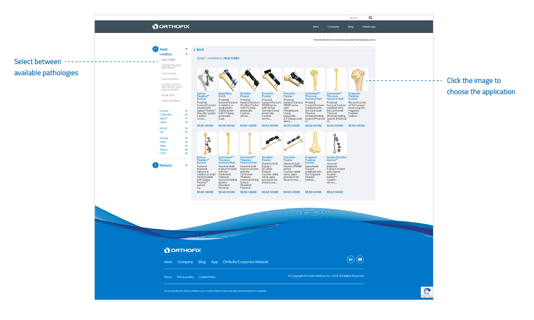 What is Orthofix ABS? - Orthofix